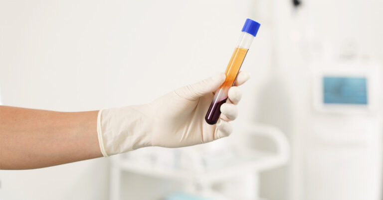 When to Consider Ovarian Rejuvenation PRP Treatment in IVF? - Punta Mita